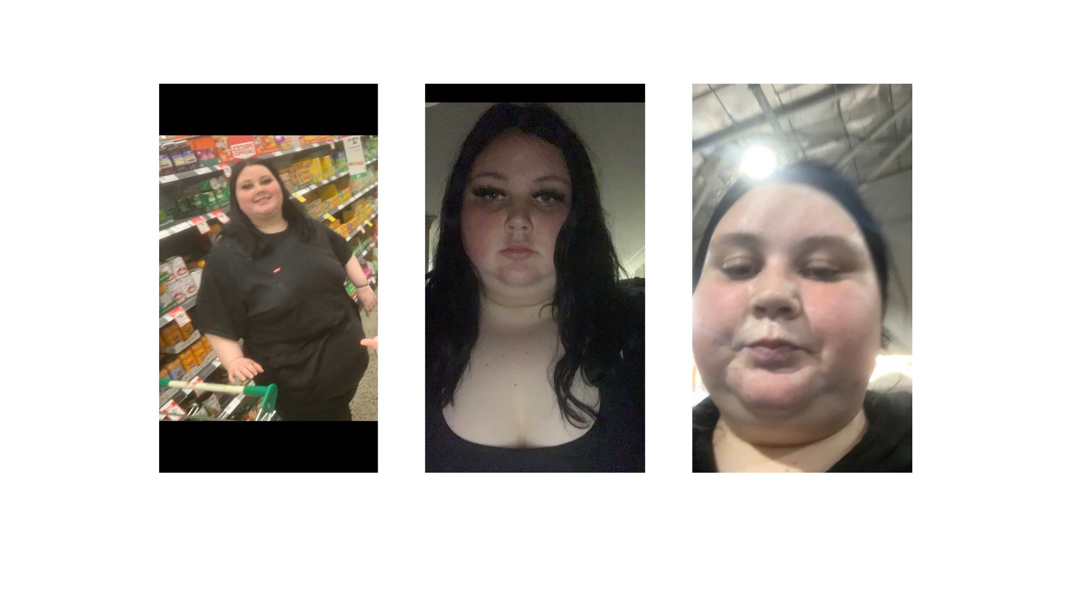 Weight Loss Surgery weight-loss-surgery